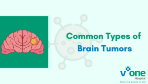 Common Types of Brain Tumors | Brain Cancer Treatment Options