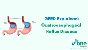 GERD Explained: Managing Gastroesophageal Reflux Disease